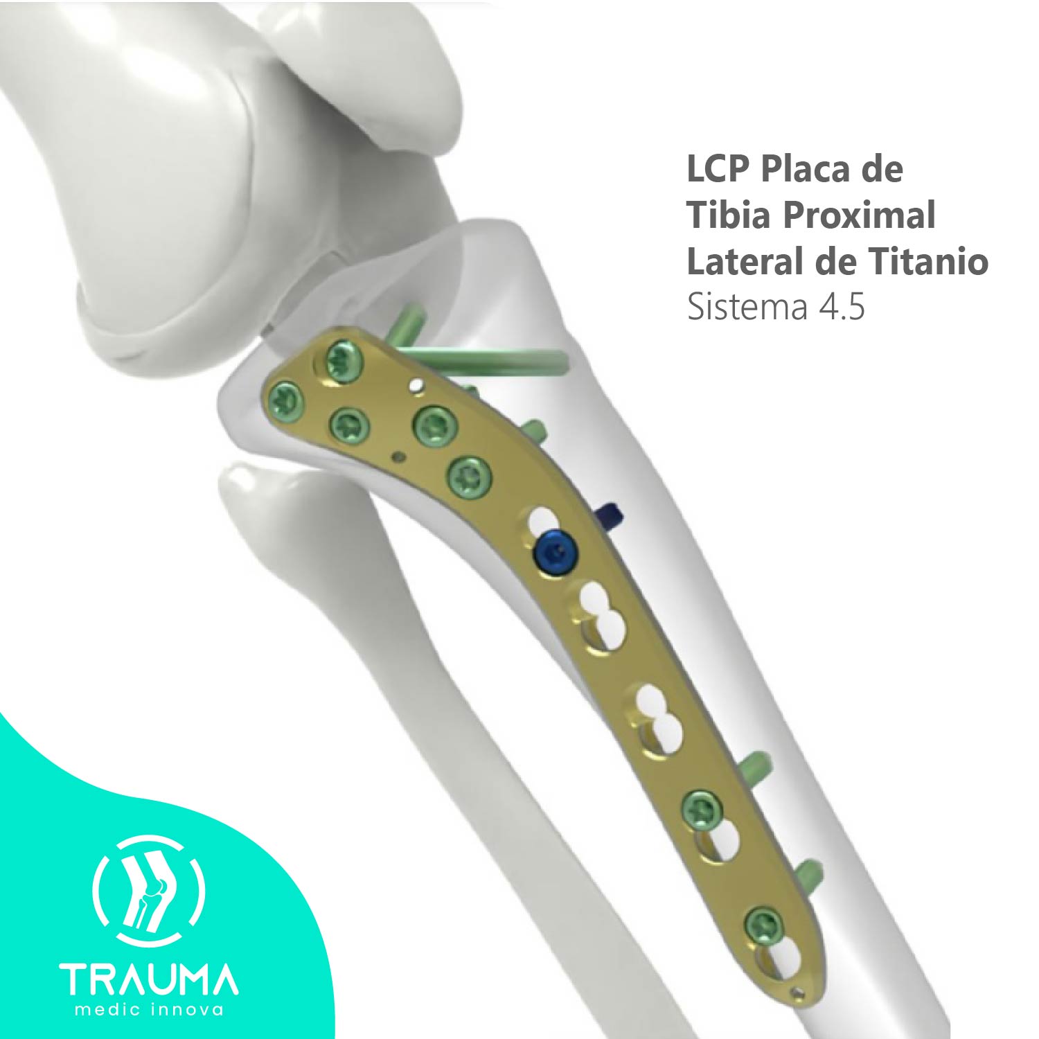 LCP Placa de Tibia Proximal Lateral de Titanio – Trauma Medic Innova