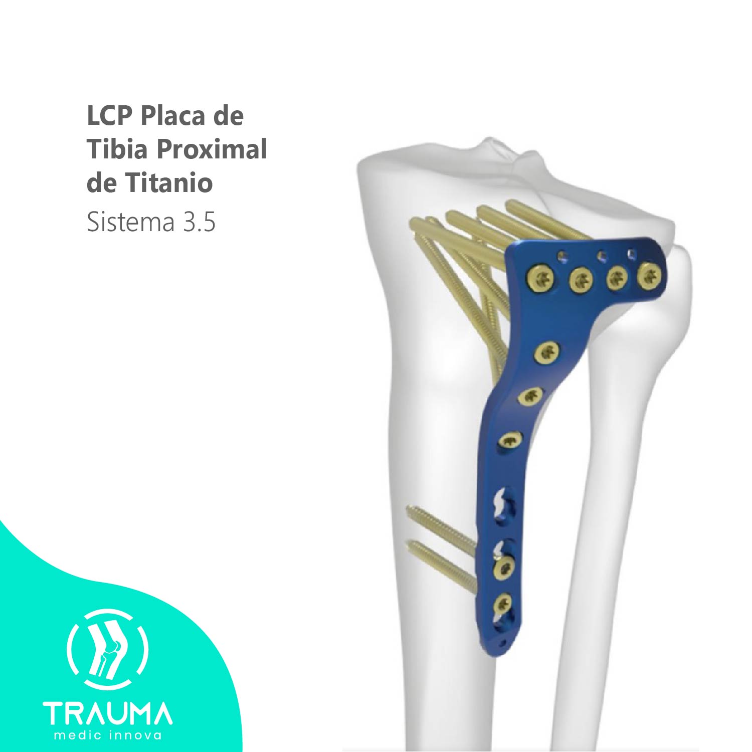 LCP Placa de Tibia Proximal de Titanio – Trauma Medic Innova